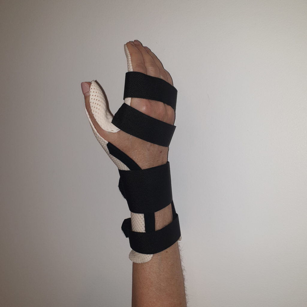 L’orthèse, ou attelle de capener. - Orthèses et atelles main ...